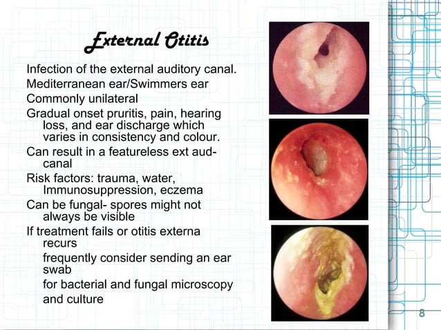 EAR: Common Conditions the GPs Should Know | PDF