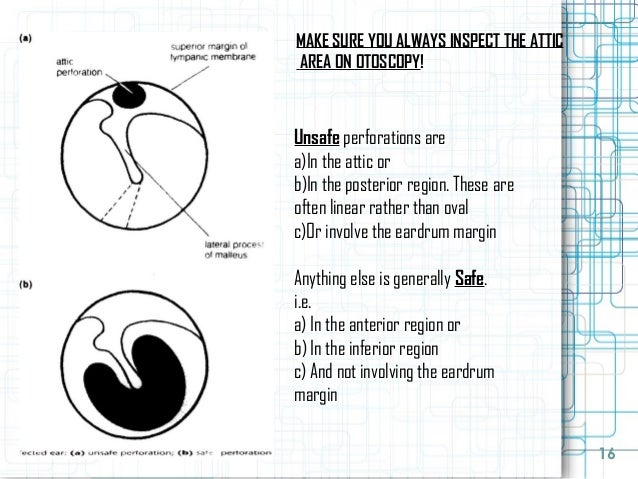 EAR: Common Conditions the GPs Should Know
