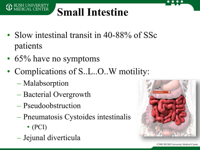 Scleroderma and the GI Tract | PPT