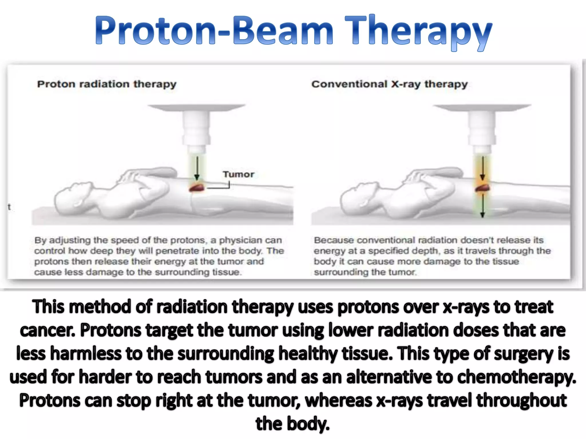5 Critical Safety Improvements in Radiation Therapy | PPT