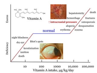 Pathophysiology of IIH | PPT