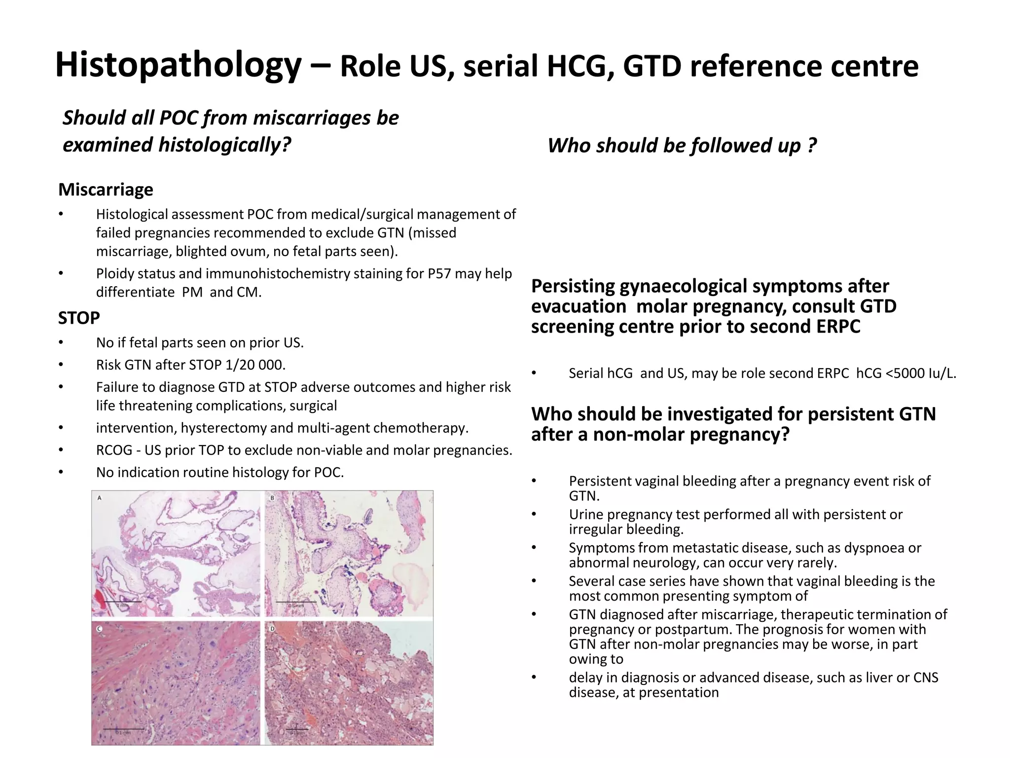 Gynaecology - Early Pregnancy Complication | PDF