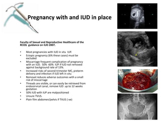 Gynaecology - Early Pregnancy Complication | PDF