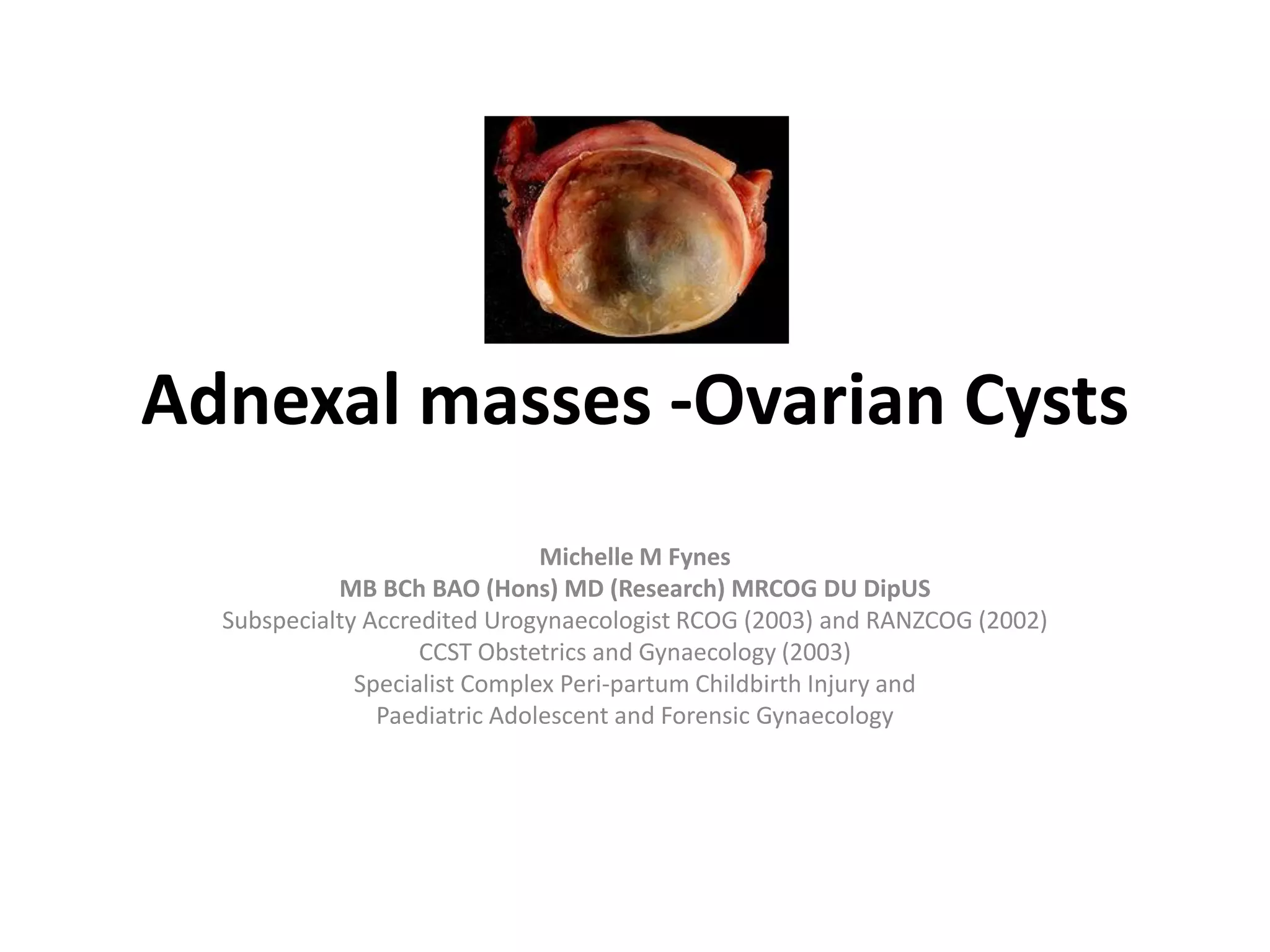 Adnexal masses - Ovarian Cysts (2008) | PDF