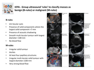 Adnexal masses - Ovarian Cysts (2008) | PDF