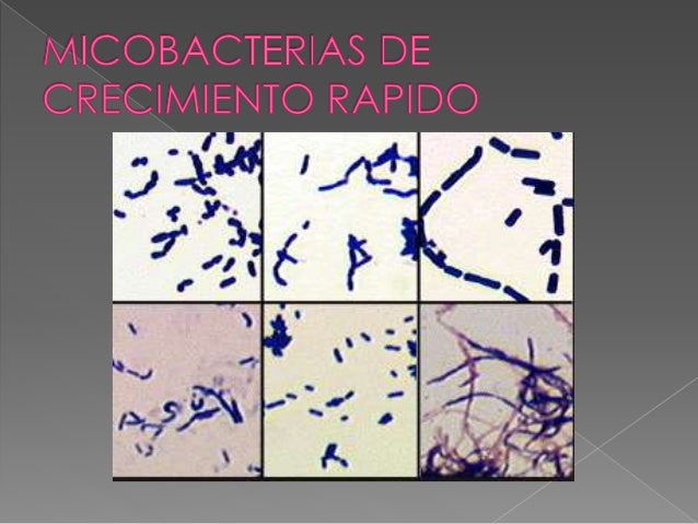 Micobacterias de crecimiento rapido