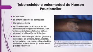 Micobacterium leprae | PPTX