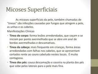 Micoses superficiais e candidíase | PPTX