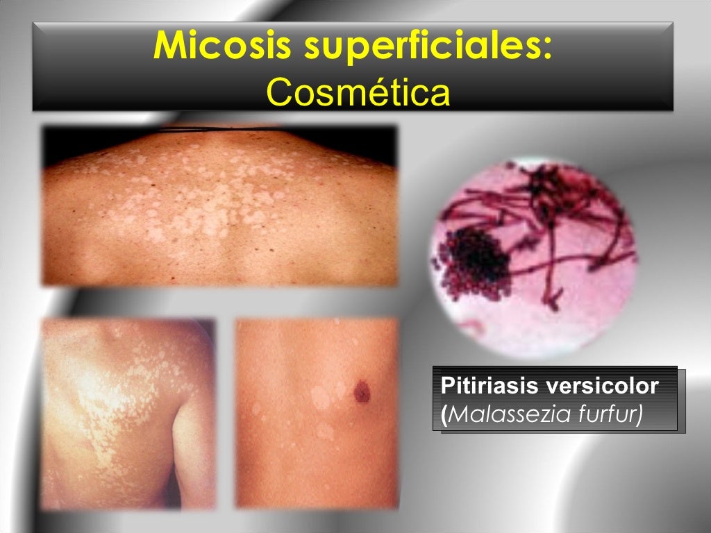 Micosis Resumen Repaso De Micologia Docente Oscar Salazar O Images