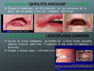 (2017-03-09)Micosis superficiales (PPT) | PPTX