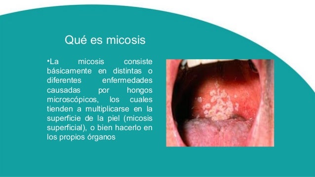 Micosis
