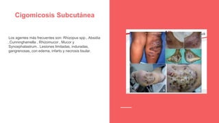 Micosis | PPTX