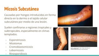 Micosis | PPTX