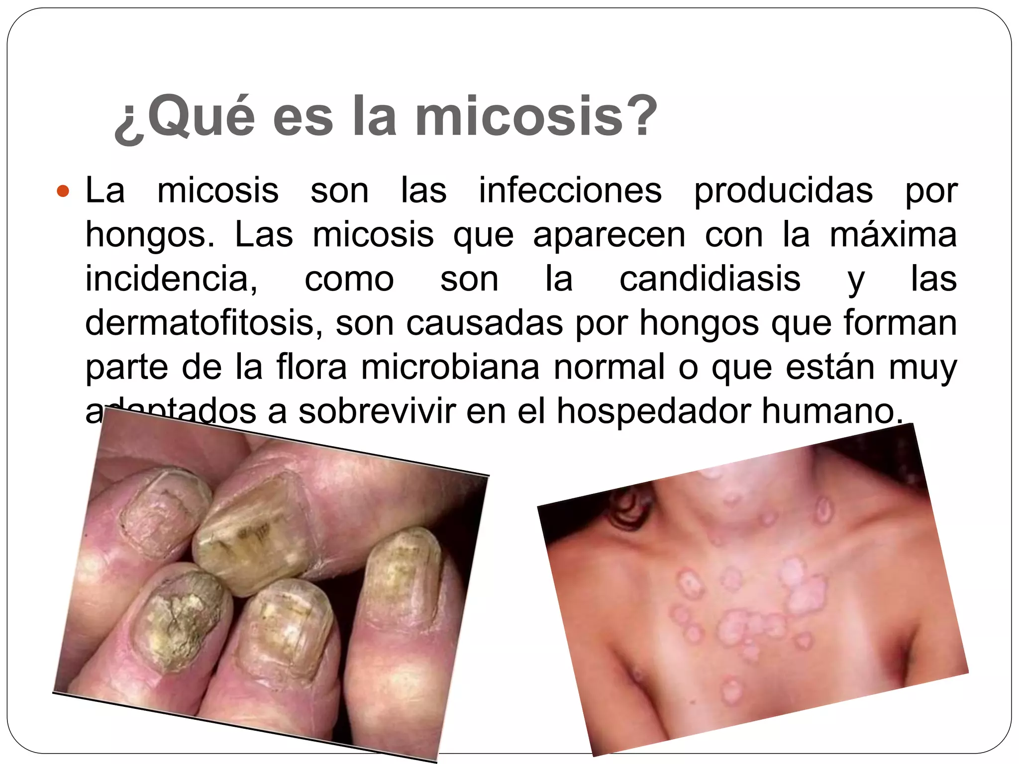 Micosis | PPTX