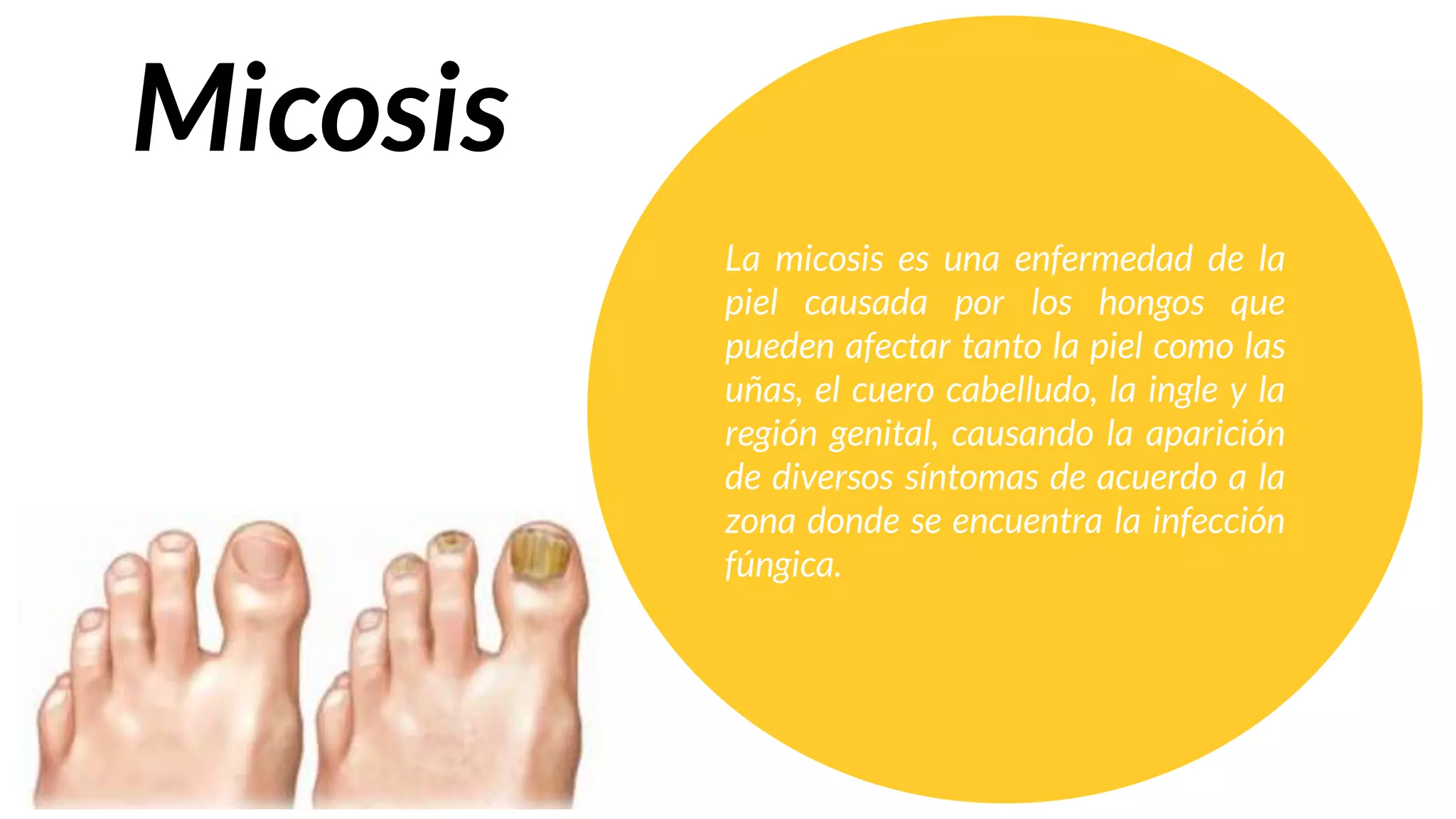 Micosis | PPT
