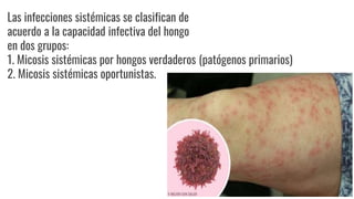 Micosis | PPTX