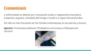 Micosis | PDF