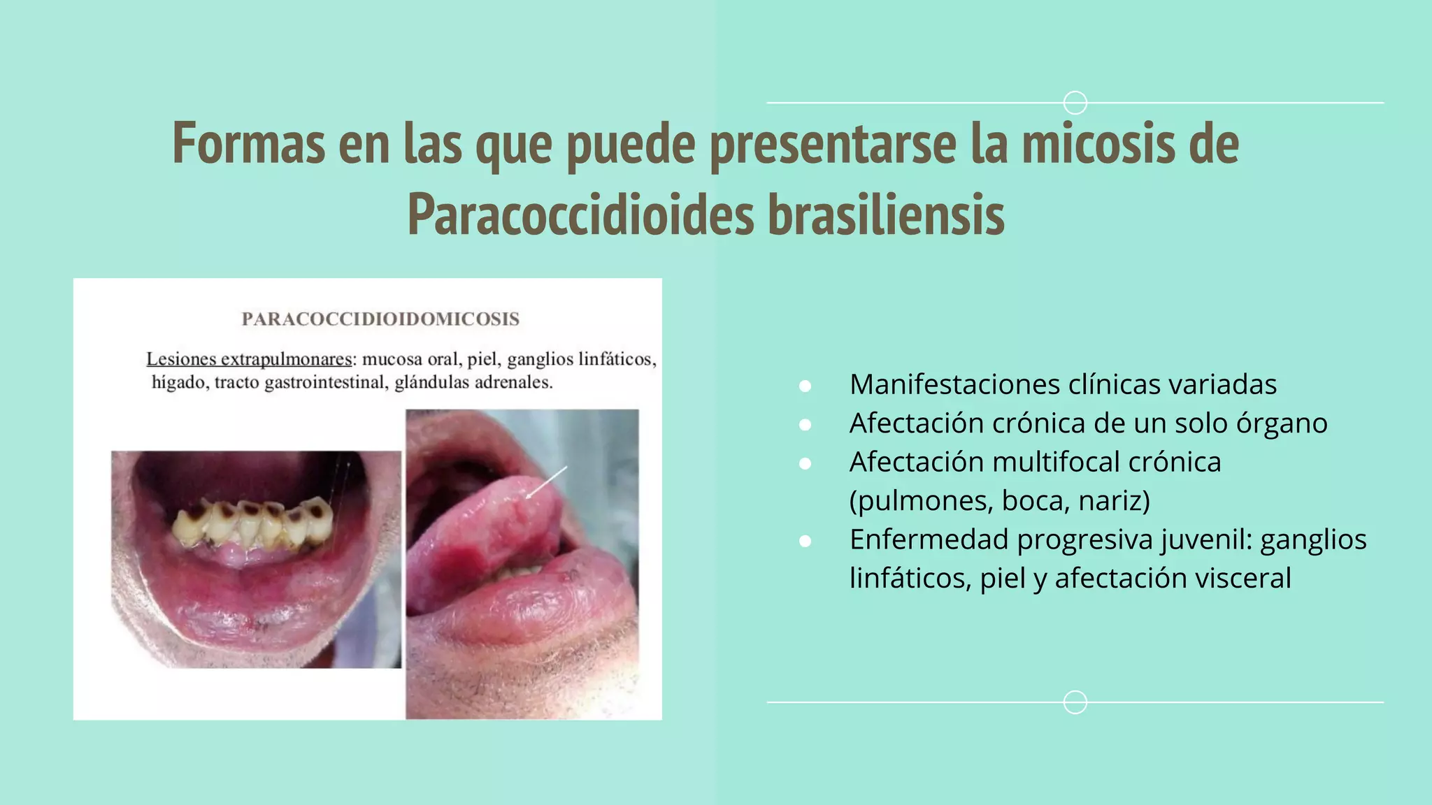Micosis | PDF