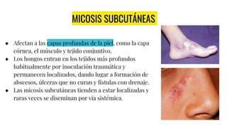 Micosis | PPTX