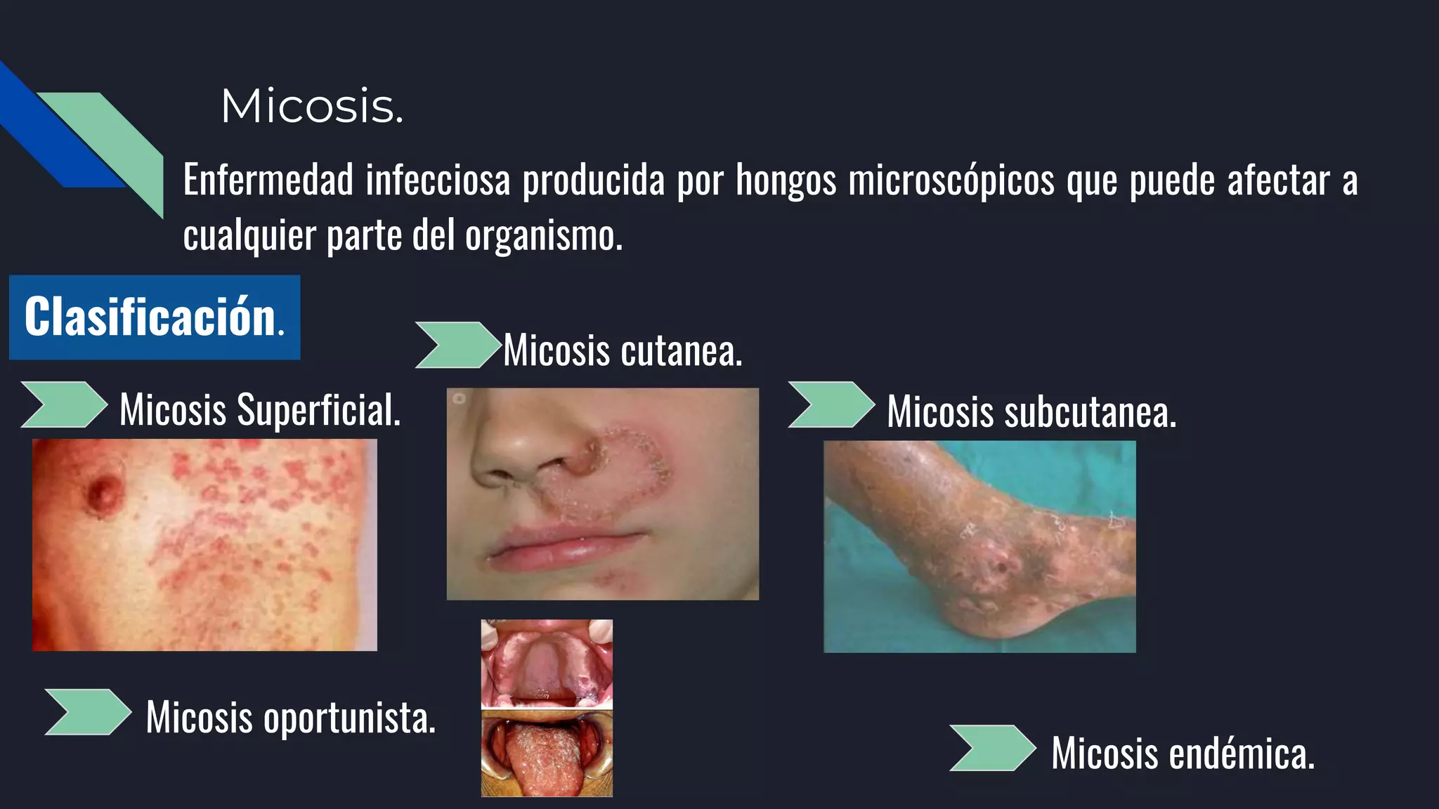 Micosis | PPT
