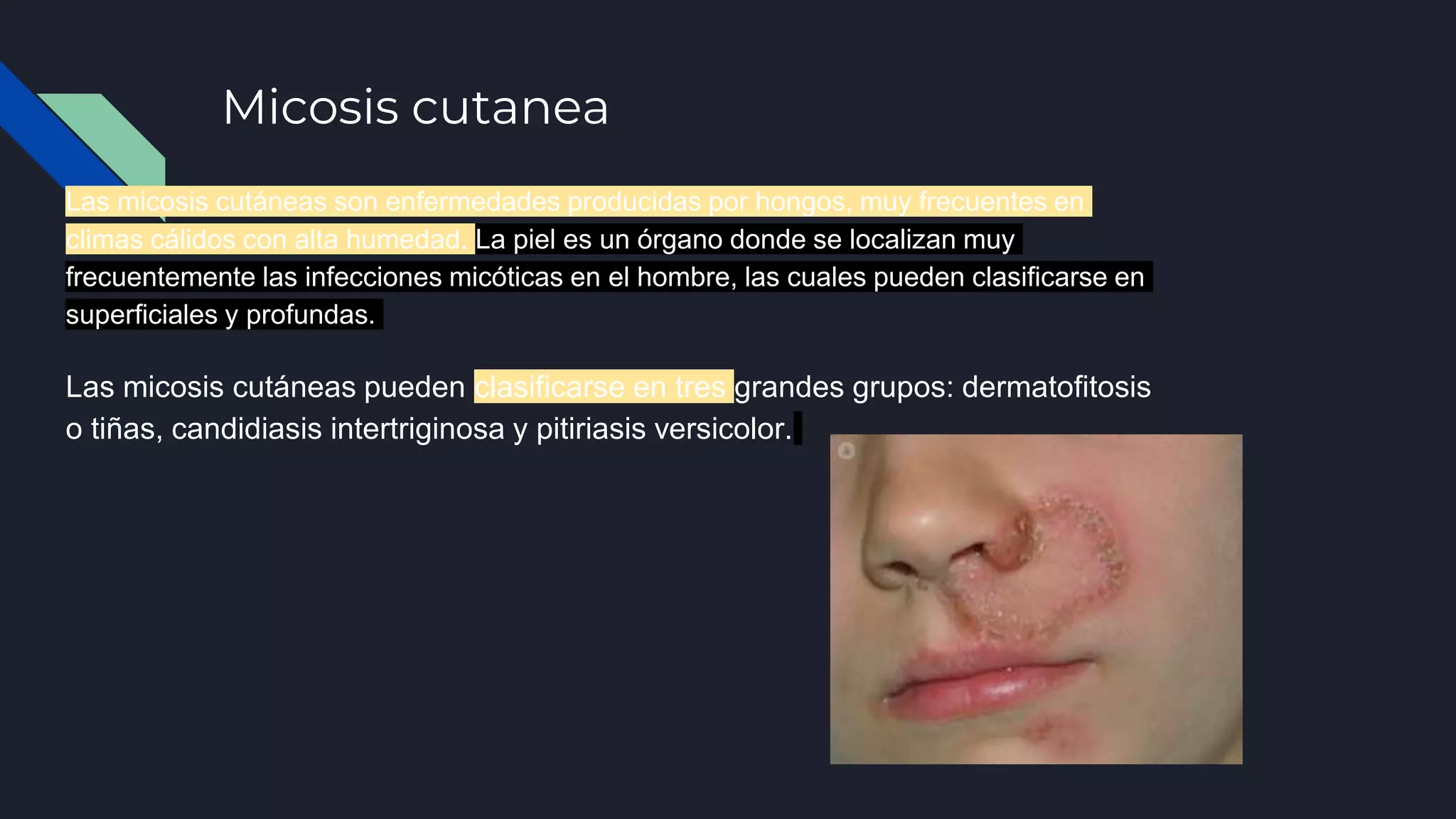 Micosis | PPT