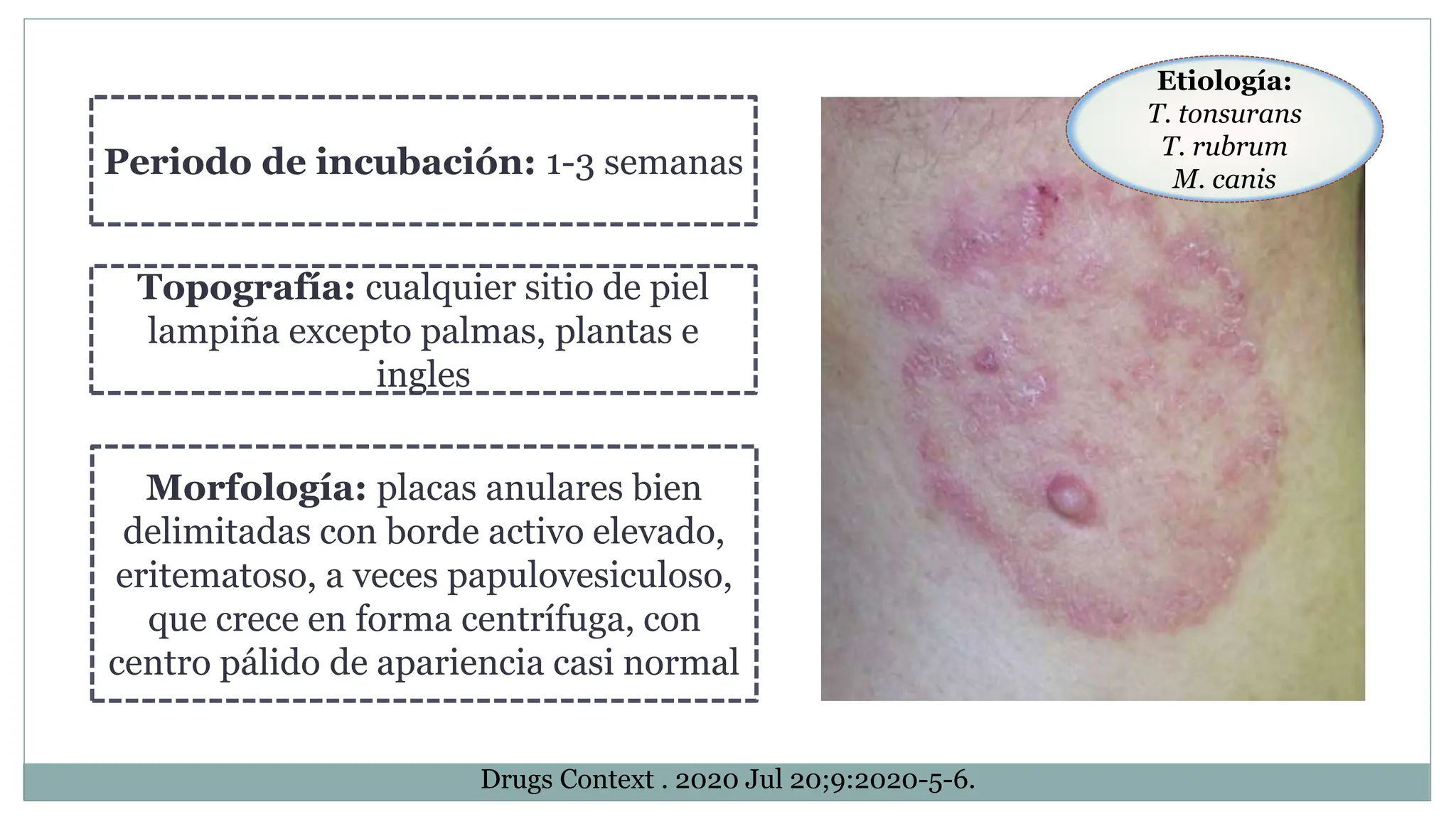 Dermatofitos, cómo enfermedad de etiología fungica en crecimiento. | PPT