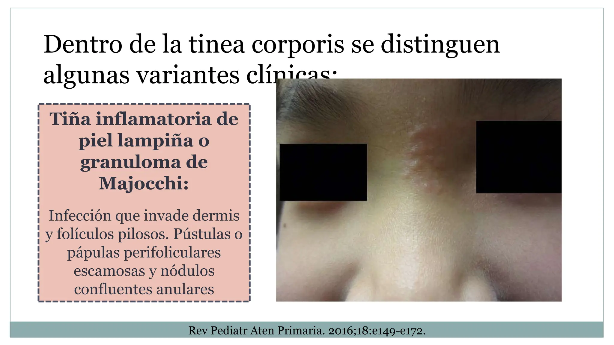 Dermatofitos, cómo enfermedad de etiología fungica en crecimiento. | PPT