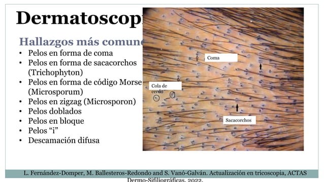 Dermatofitos, cómo enfermedad de etiología fungica en crecimiento. | PPT