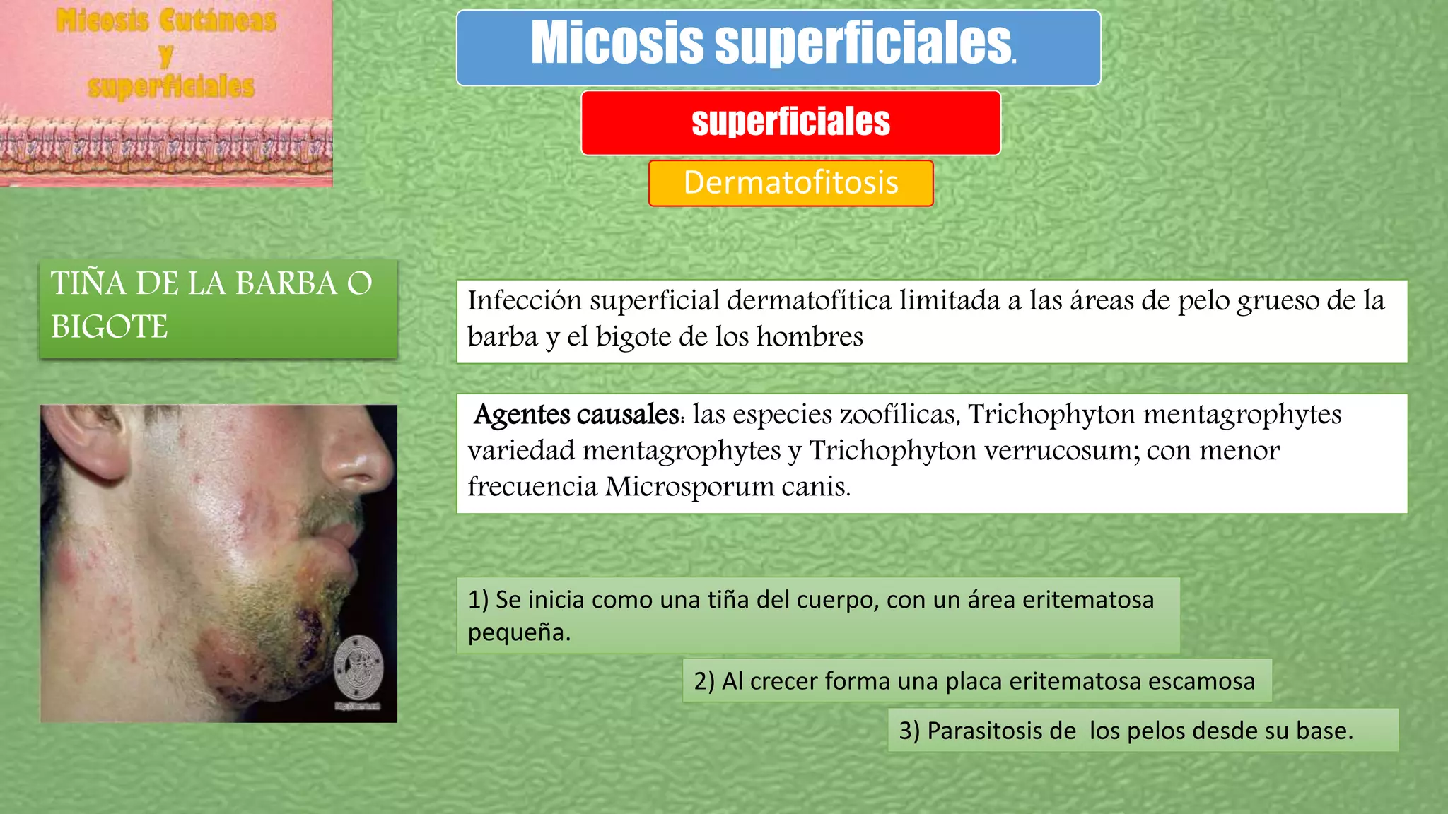 Micosis superficiales y cutáneas | PPTX