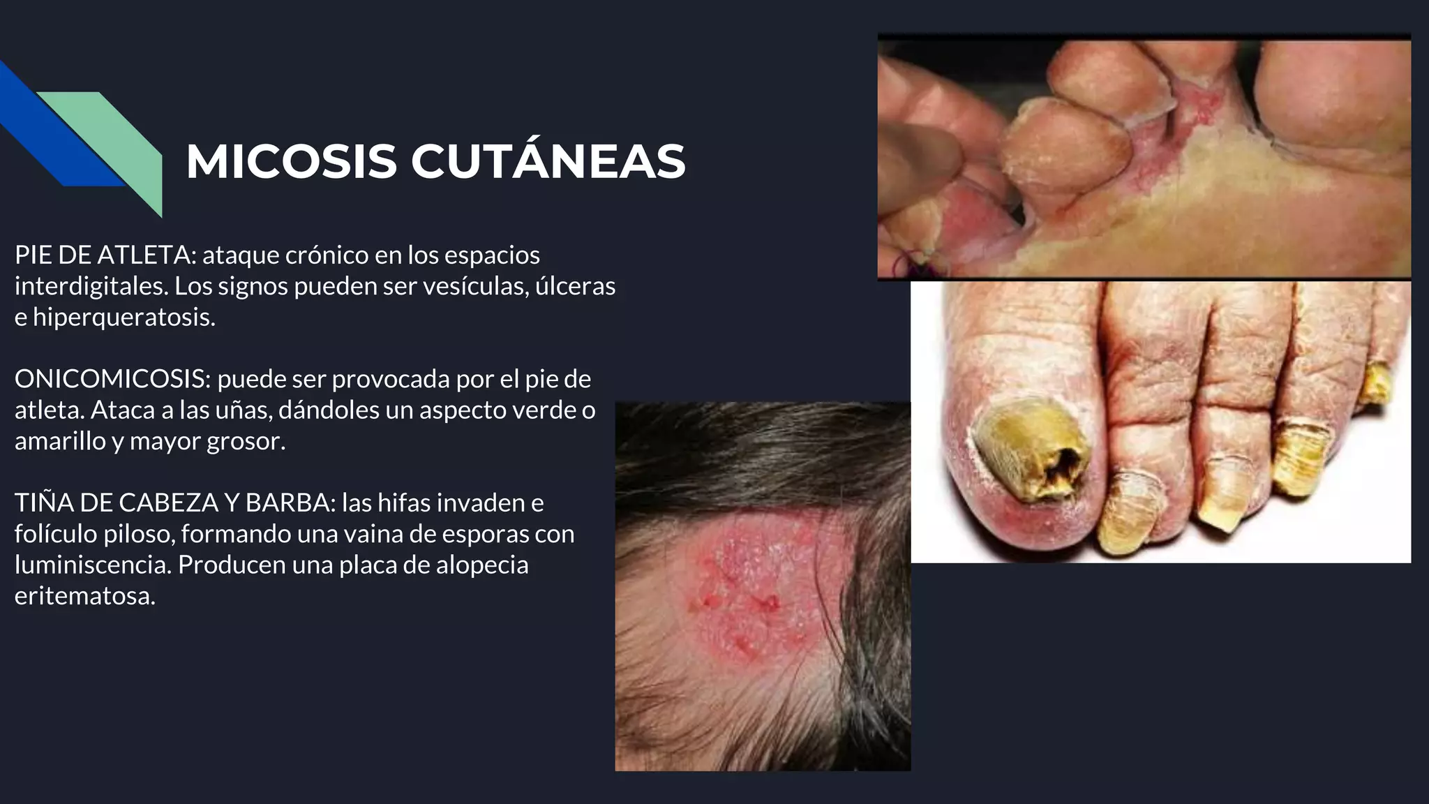 Microbiología: Micosis | PPT