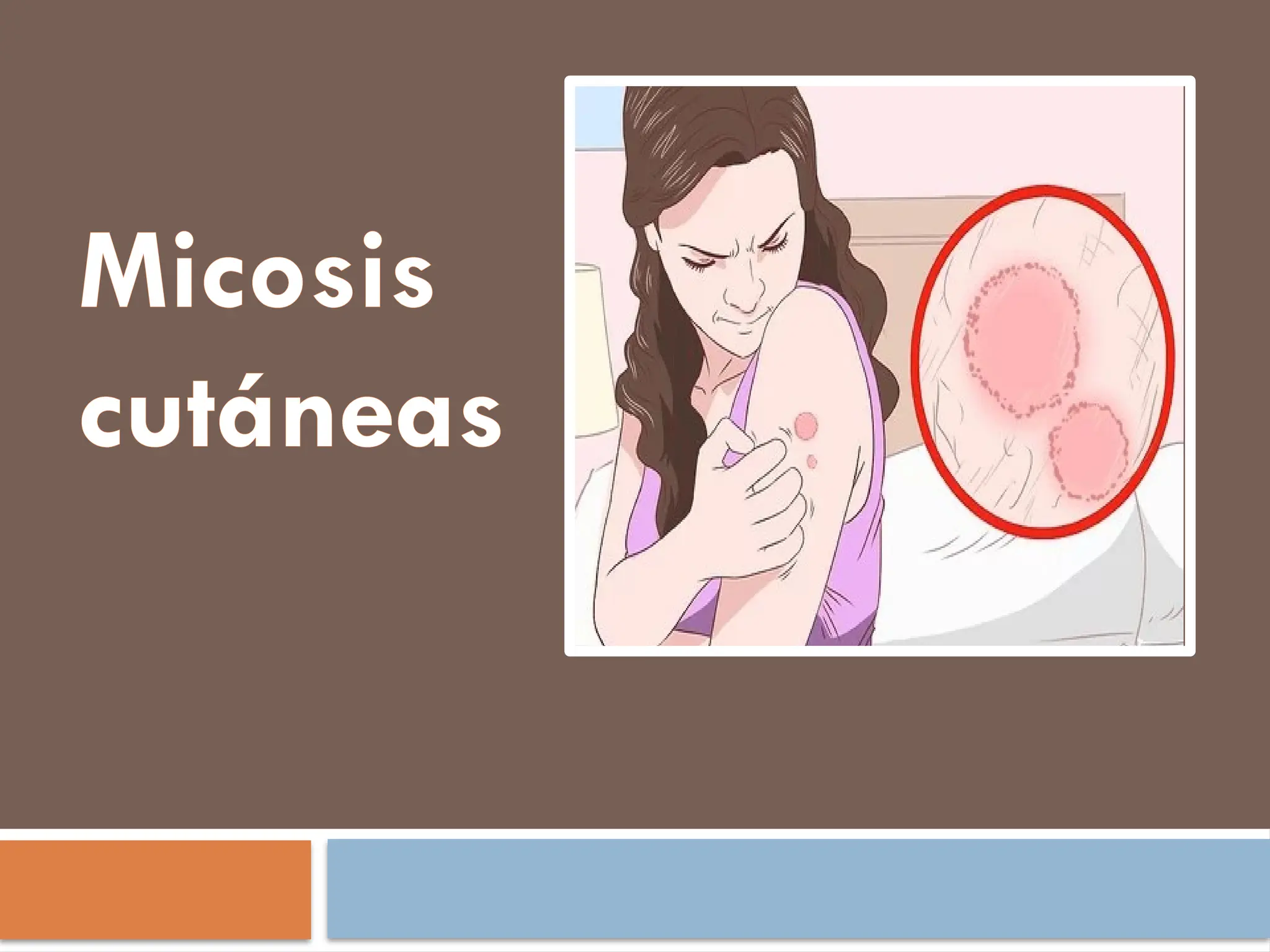 tipos de Micosis y tratamiento farmacológico | PPT
