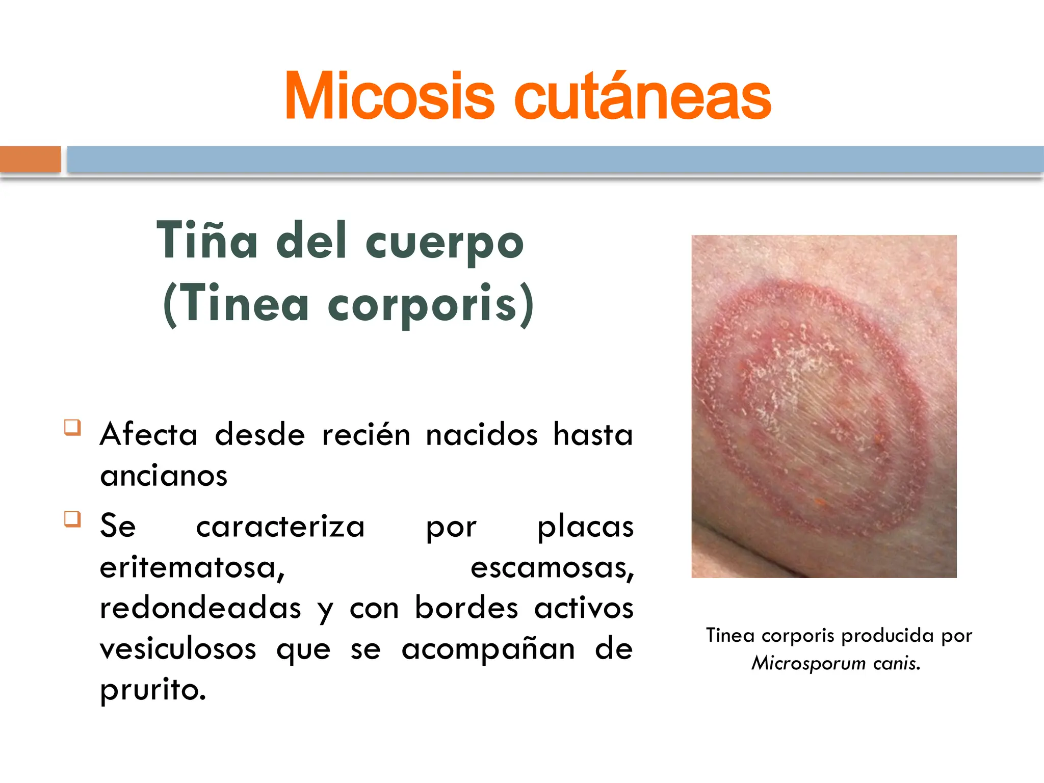 tipos de Micosis y tratamiento farmacológico | PPT