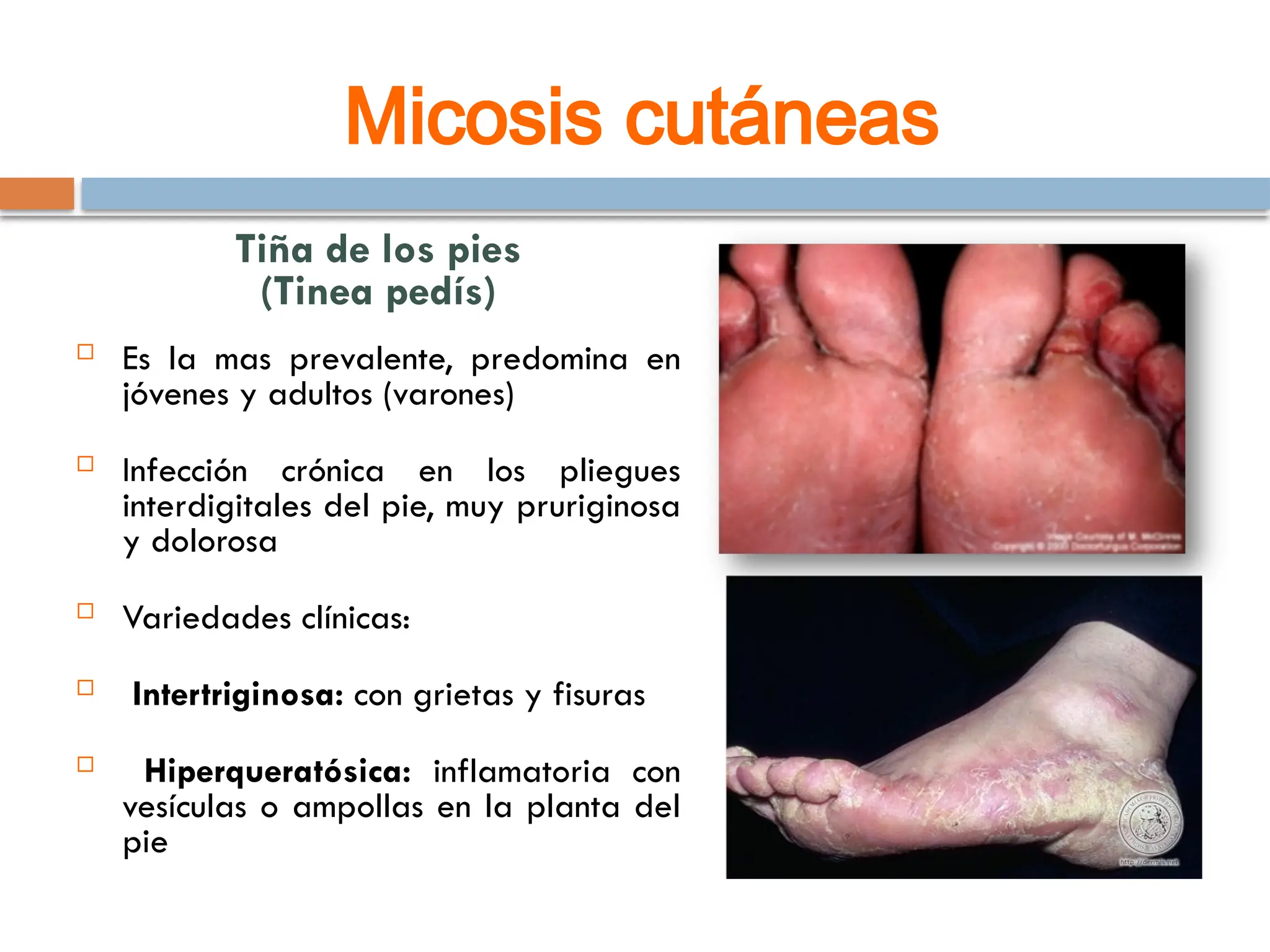 tipos de Micosis y tratamiento farmacológico | PPT