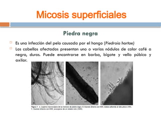 tipos de Micosis y tratamiento farmacológico | PPTX