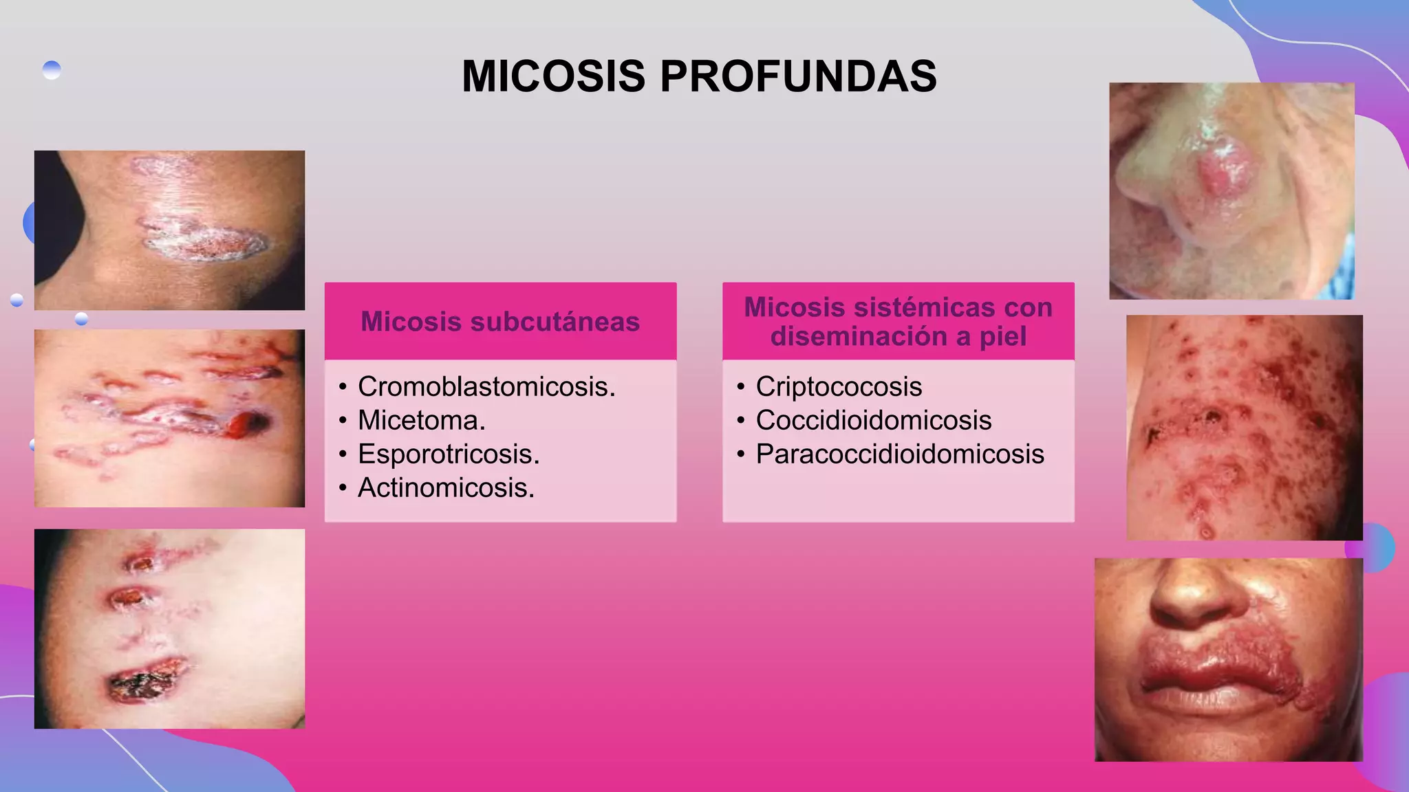 Micosis profundas. .pptx