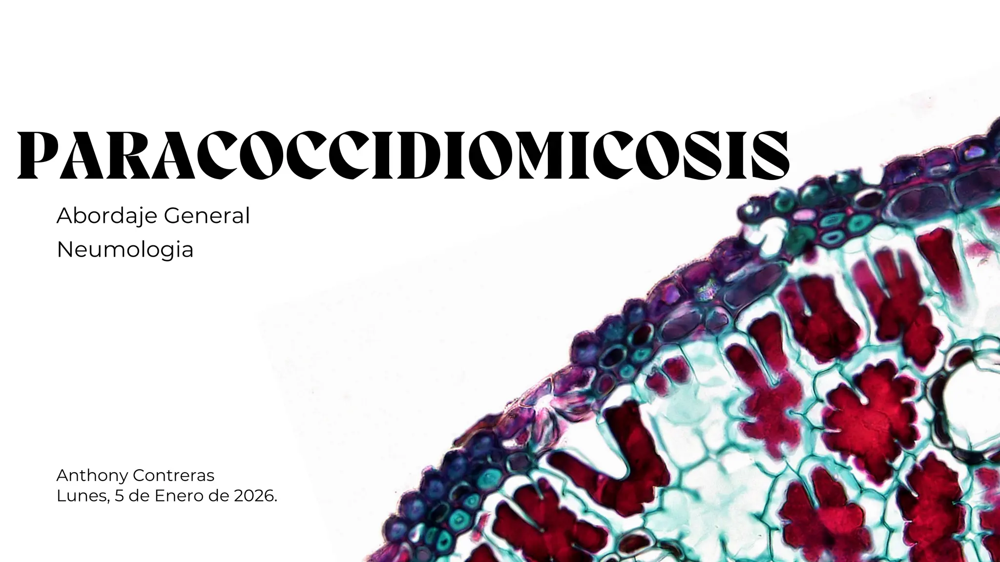 MICOSIS PULMONAR COCCIDIOMICOSIS Y PARACOCCIDIOMICOSIS | PDF