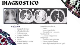MICOSIS PULMONAR COCCIDIOMICOSIS Y PARACOCCIDIOMICOSIS | PDF