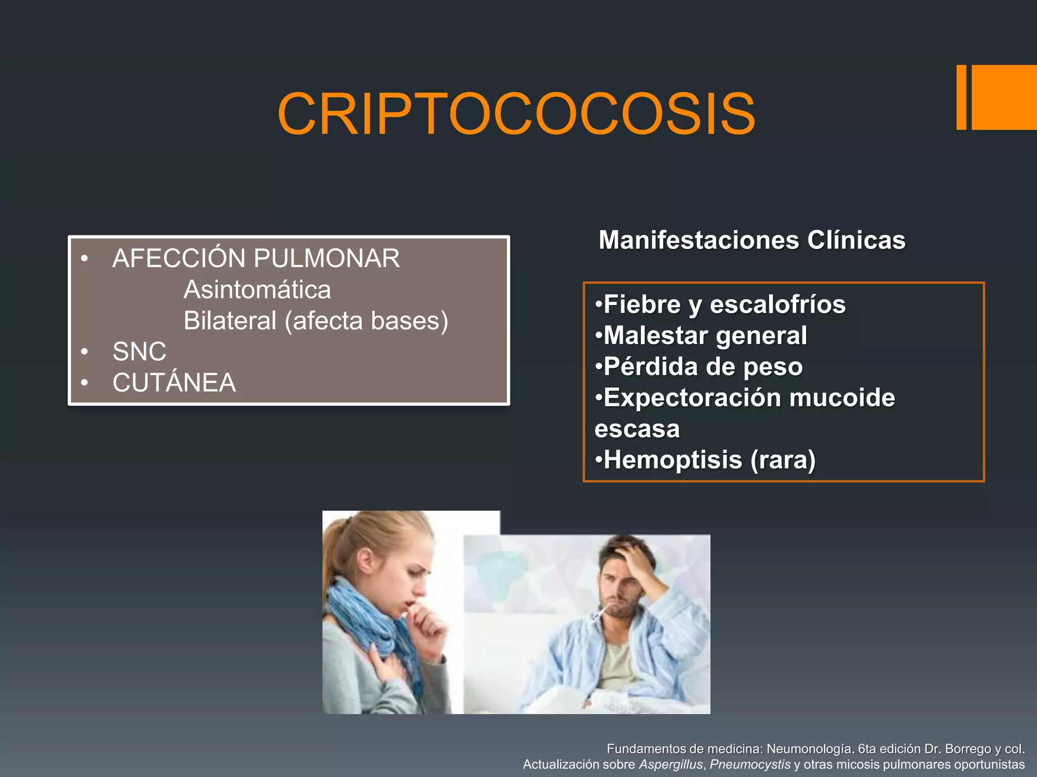 Micosis Pulmonar.pptx