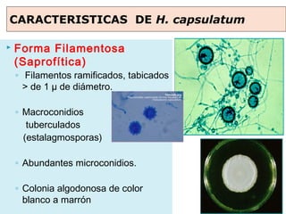 Micosis Sistemicas y Oportunistas | PPT