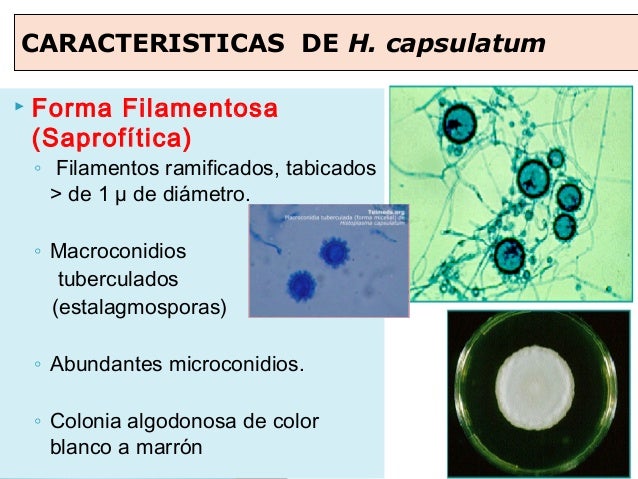 Micosis Sistemicas y Oportunistas