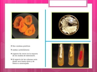 Micosis subcutánea | PPTX