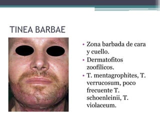 Micosis superficiales | PPTX