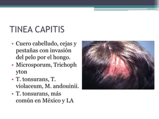 Micosis superficiales | PPTX