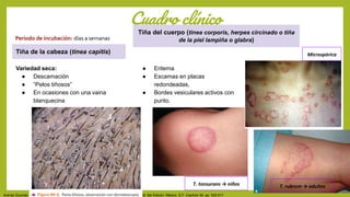 Micosis superficiales.pptx