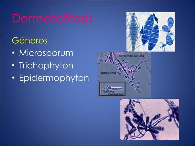 Micosis Superficialesppt