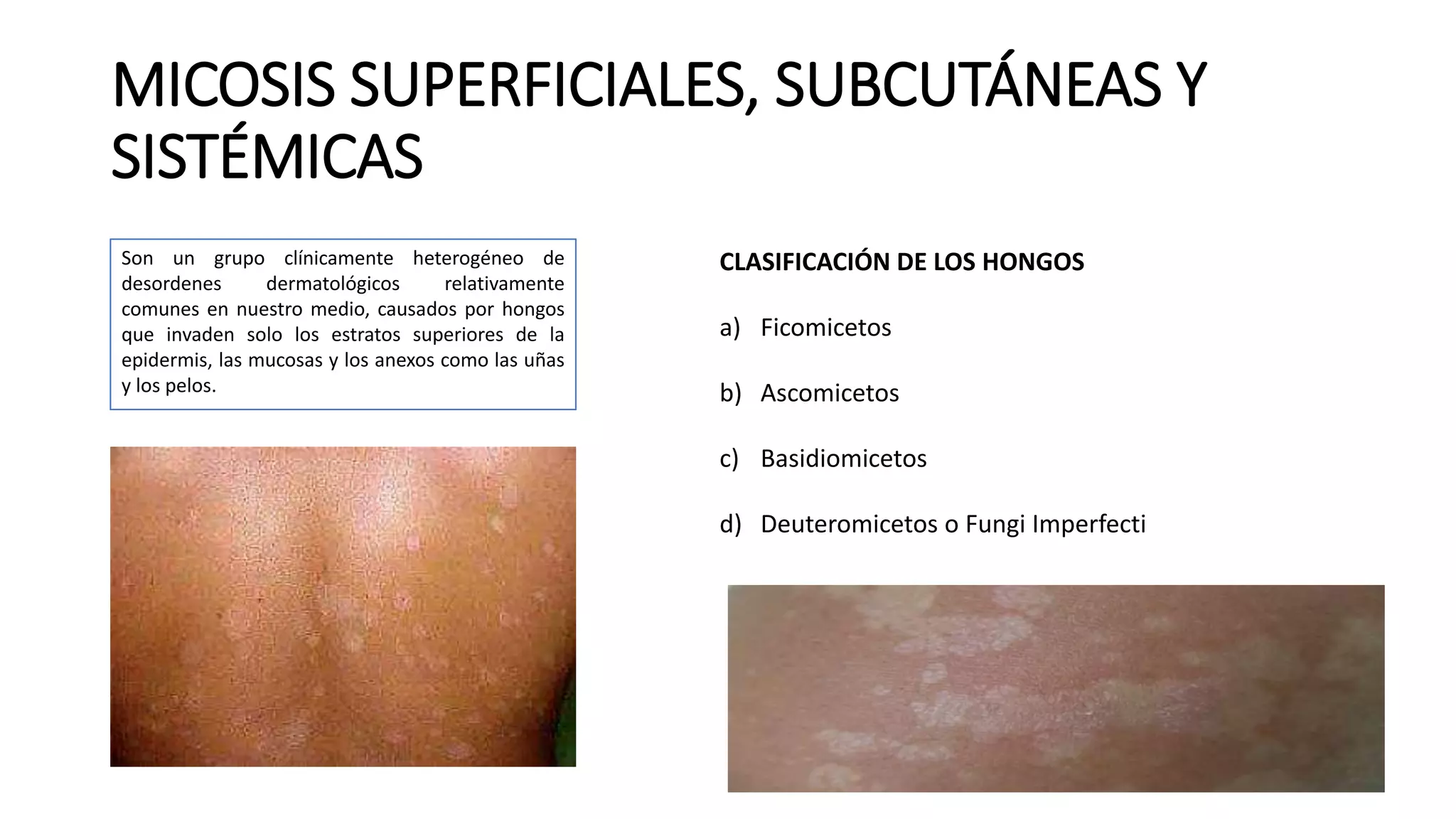 micosis y parasitosis completo (2).pptx