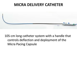 Micra™ WIRELESS Permanent pacemaker | PPTX