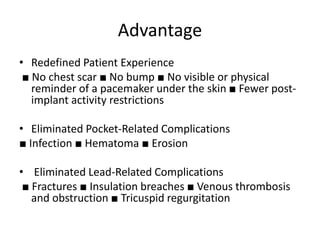 Micra™ WIRELESS Permanent pacemaker | PPTX