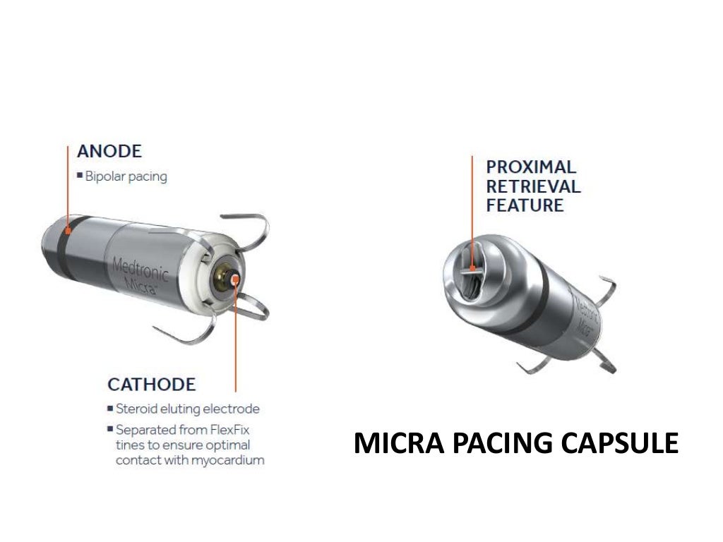 Micra™ WIRELESS Permanent pacemaker