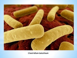 Diseases Caused by Microorganisms- Botulism | PPTX